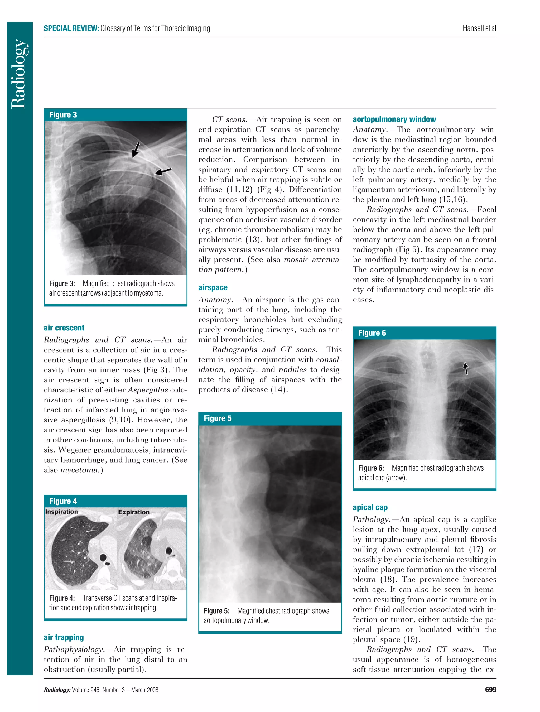Fleischner Society glosary.pdf