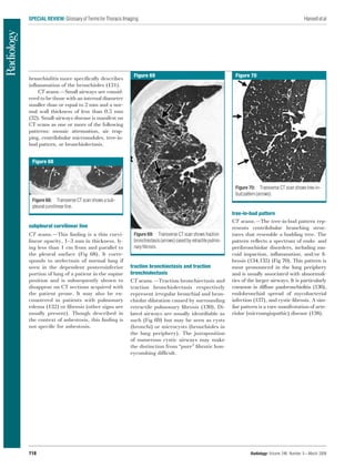 Fleischner Society glosary.pdf