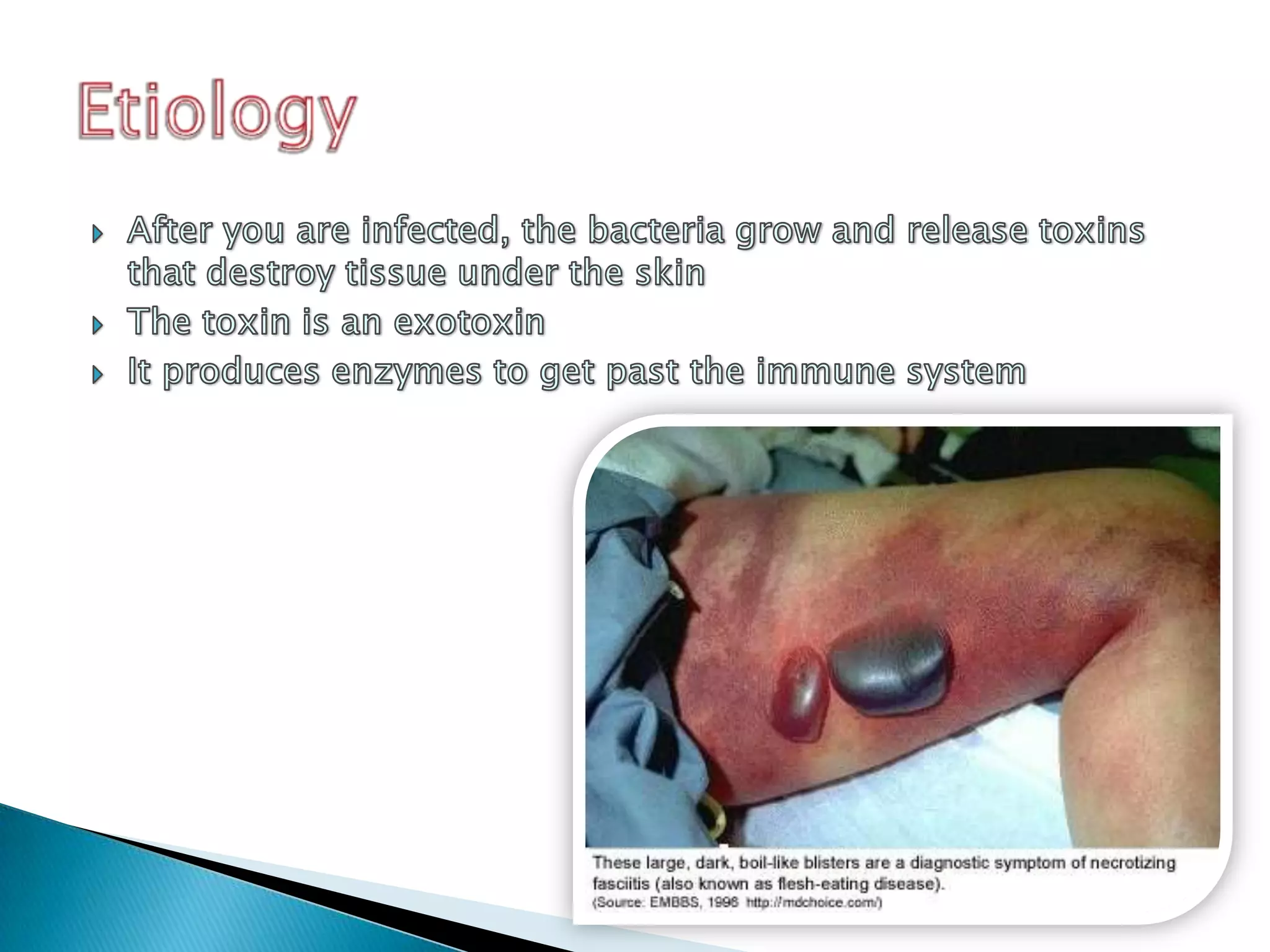 Flesh Eating Disease1 | PPTX
