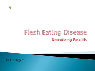 Flesh Eating Disease1 | PPTX