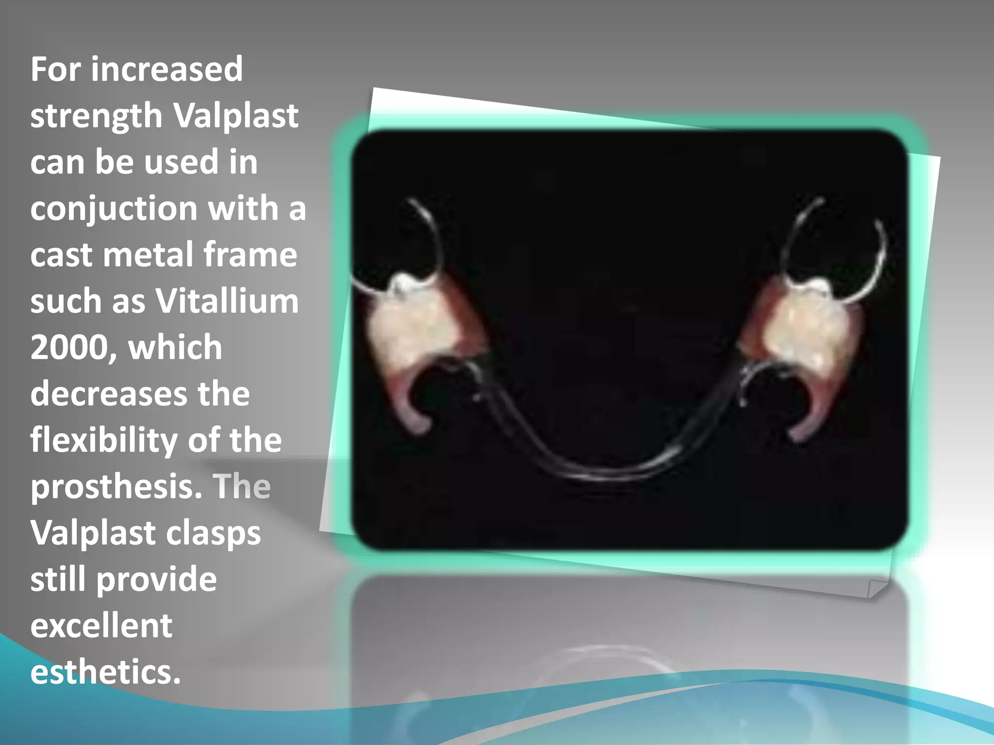 Flexible denture | PPTX