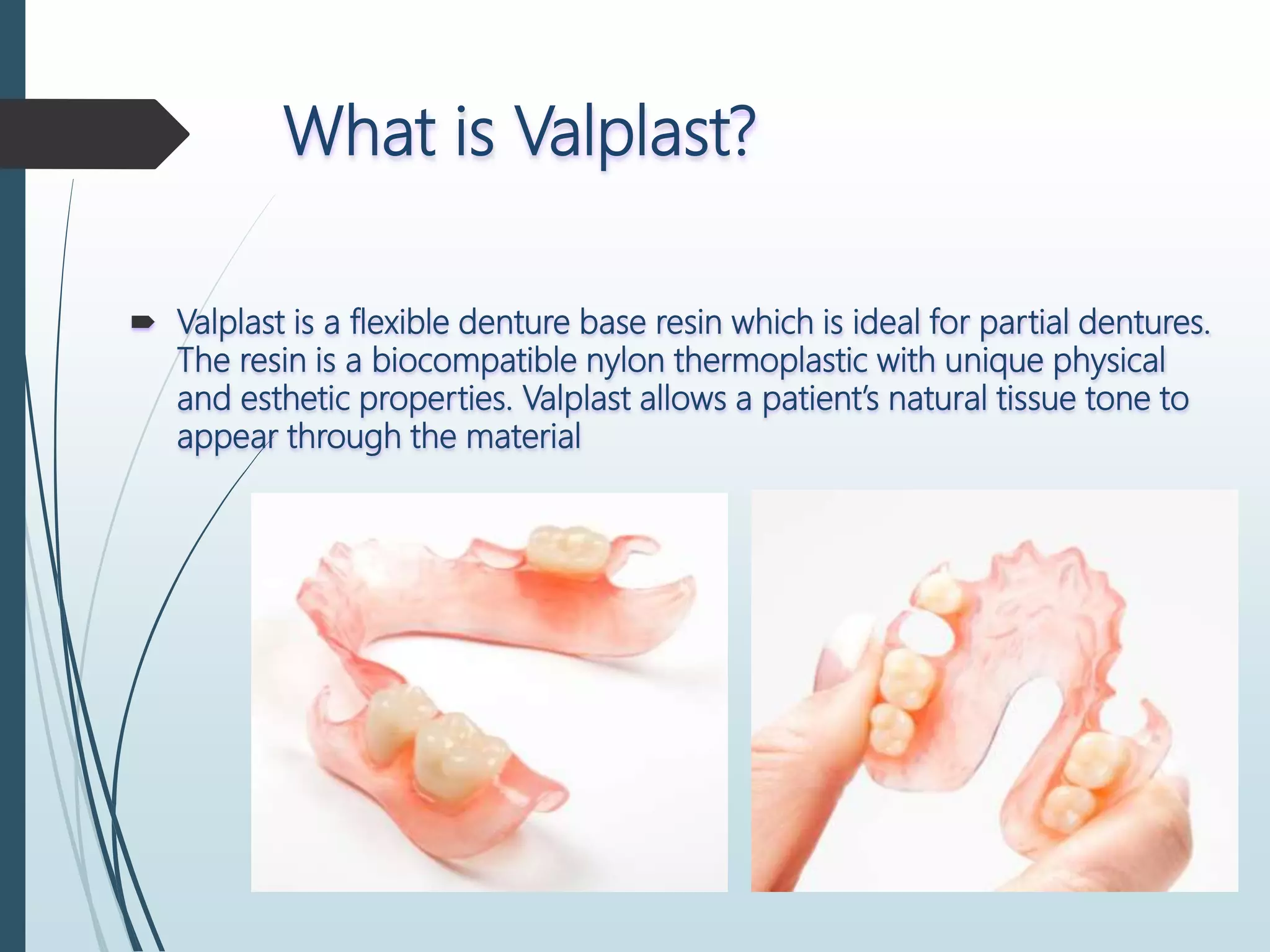 Flexible denture by dr. maryam salman | PPTX