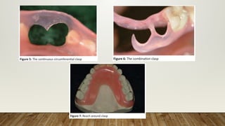Flexible Denture -Removable partial denture.pptx