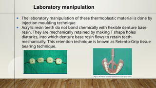 Flexible Denture -Removable partial denture.pptx