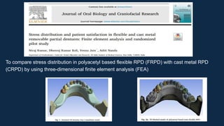 Flexible Denture -Removable partial denture.pptx