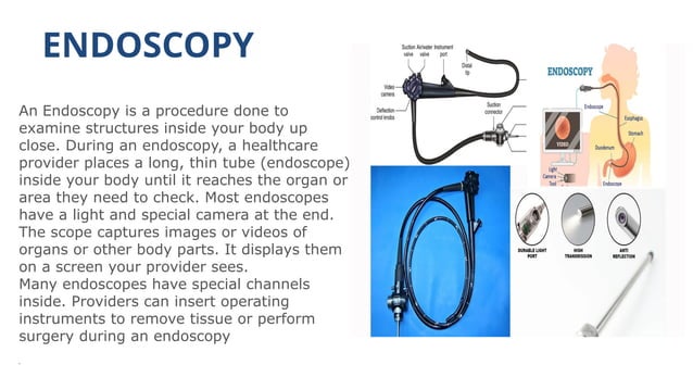 flexible endoscopes reprocessing ppt.pptx