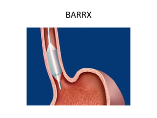 Flexible endoscopy a surgeon's perspective | PPTX