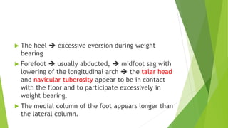 Flexible flatfoot (pes planovalgus) | PPTX