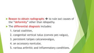Flexible flatfoot (pes planovalgus) | PPTX