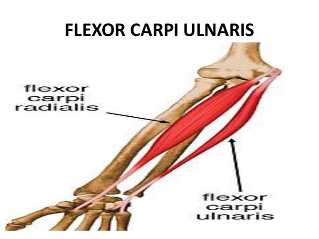 Flexion tendon injuries of hand