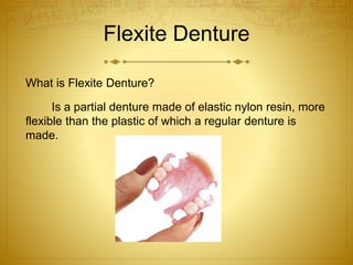 Flexite denture | PPT