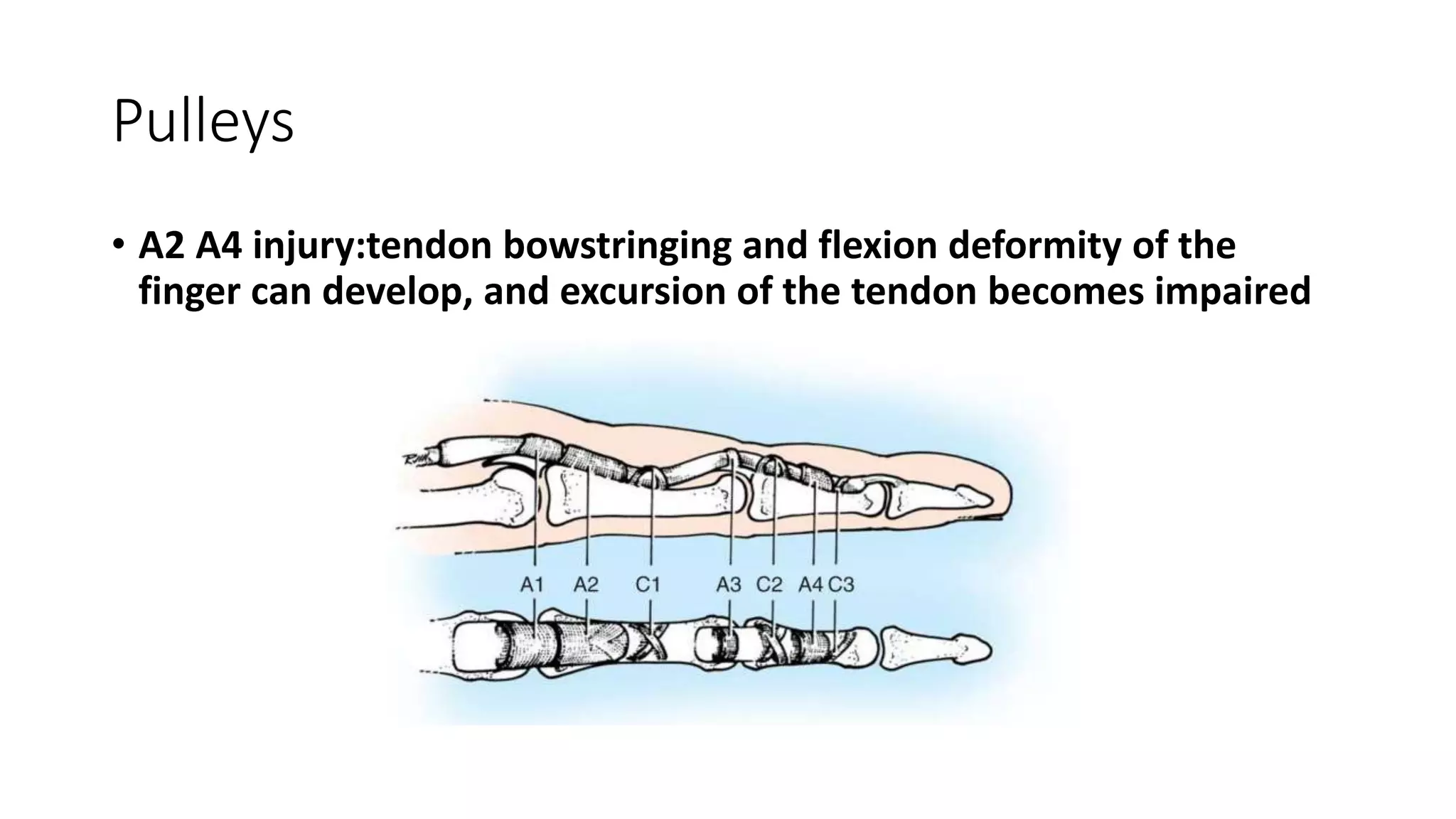 Flexor and extensor tendon injury | PPTX