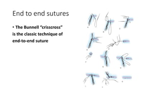 Flexor and extensor tendon injury | PPTX