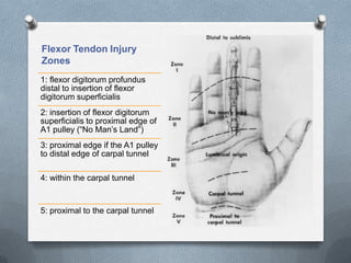 Flexor and Extensor Tendon Laceration vs. Occupational Therapy | PPTX