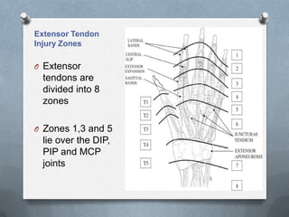 Flexor and Extensor Tendon Laceration vs. Occupational Therapy | PPT
