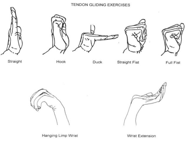 Flexor and Extensor Tendon Laceration vs. Occupational Therapy