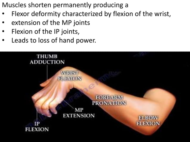 FLEXOR COMPARTMENT of forearm (1).pptx