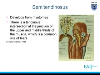 Flexor compartment of thigh | PPT
