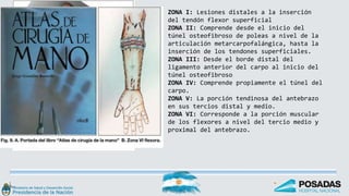 FLEXORES DE LA MANO ANATOMIA EN GENERAL. | PPTX