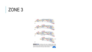 flexor tendon injury hand,flexor tendon injury hand | PPT