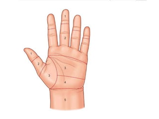 FLEXOR TENDON injury, fds,fdp,tendon injury | PPT