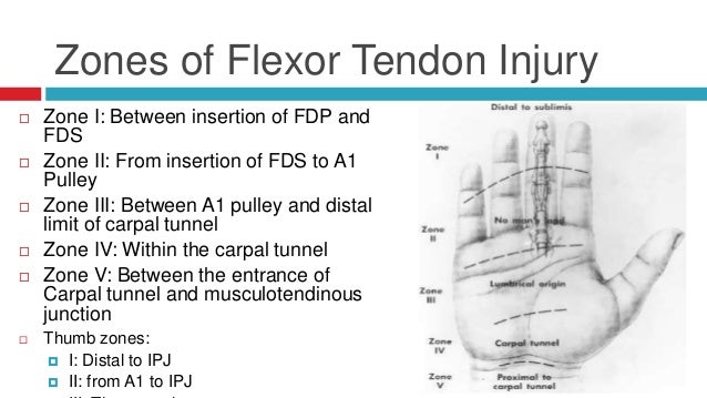Flexor tendon injuries