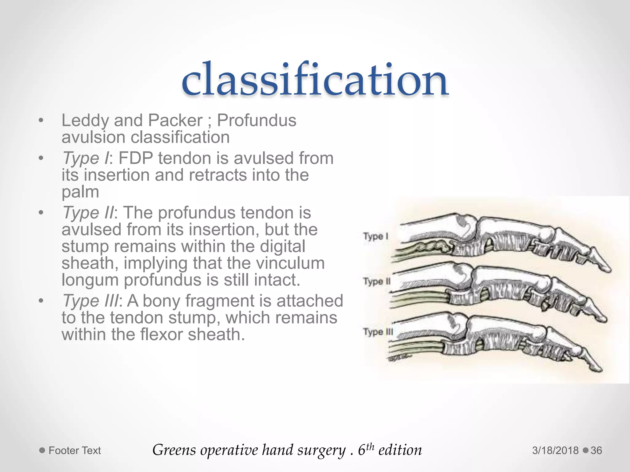 Flexor tendon injuries | PPTX