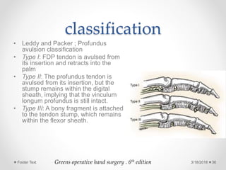 Flexor tendon injuries | PPTX