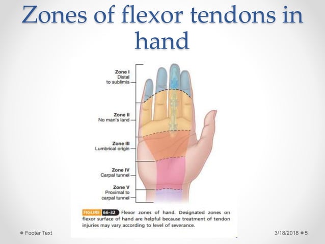 Flexor tendon injuries