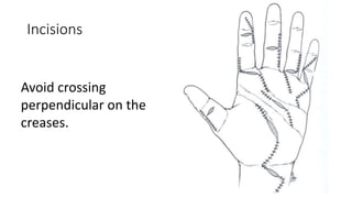 Flexor tendon injuries | PPTX