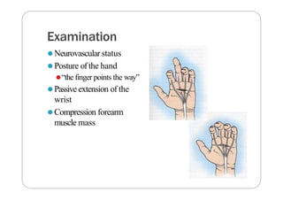 Flexor tendon injuries- basics for orthopedics residents | PPTX