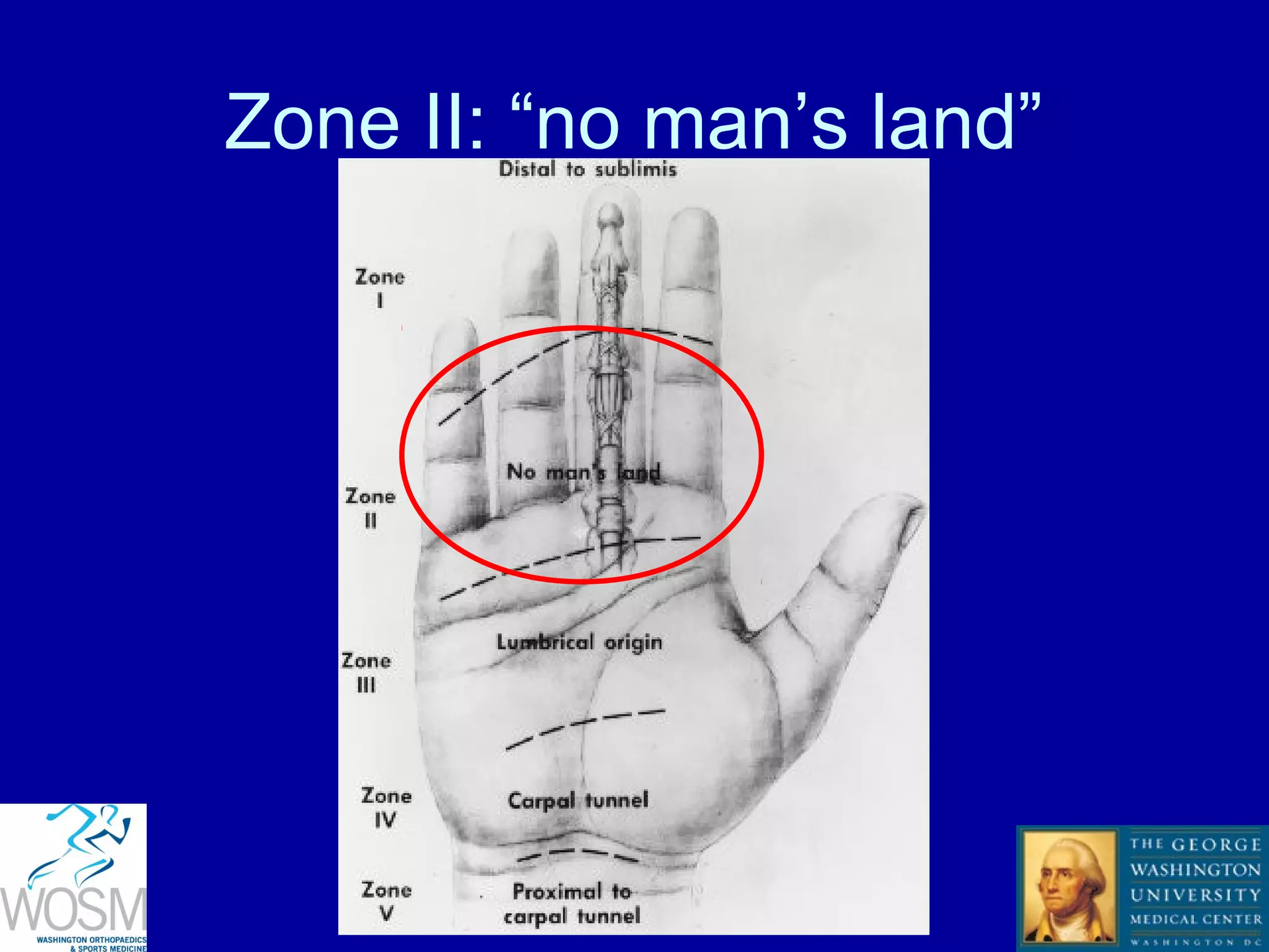 Flexor tendon injuries of the hand | PPT