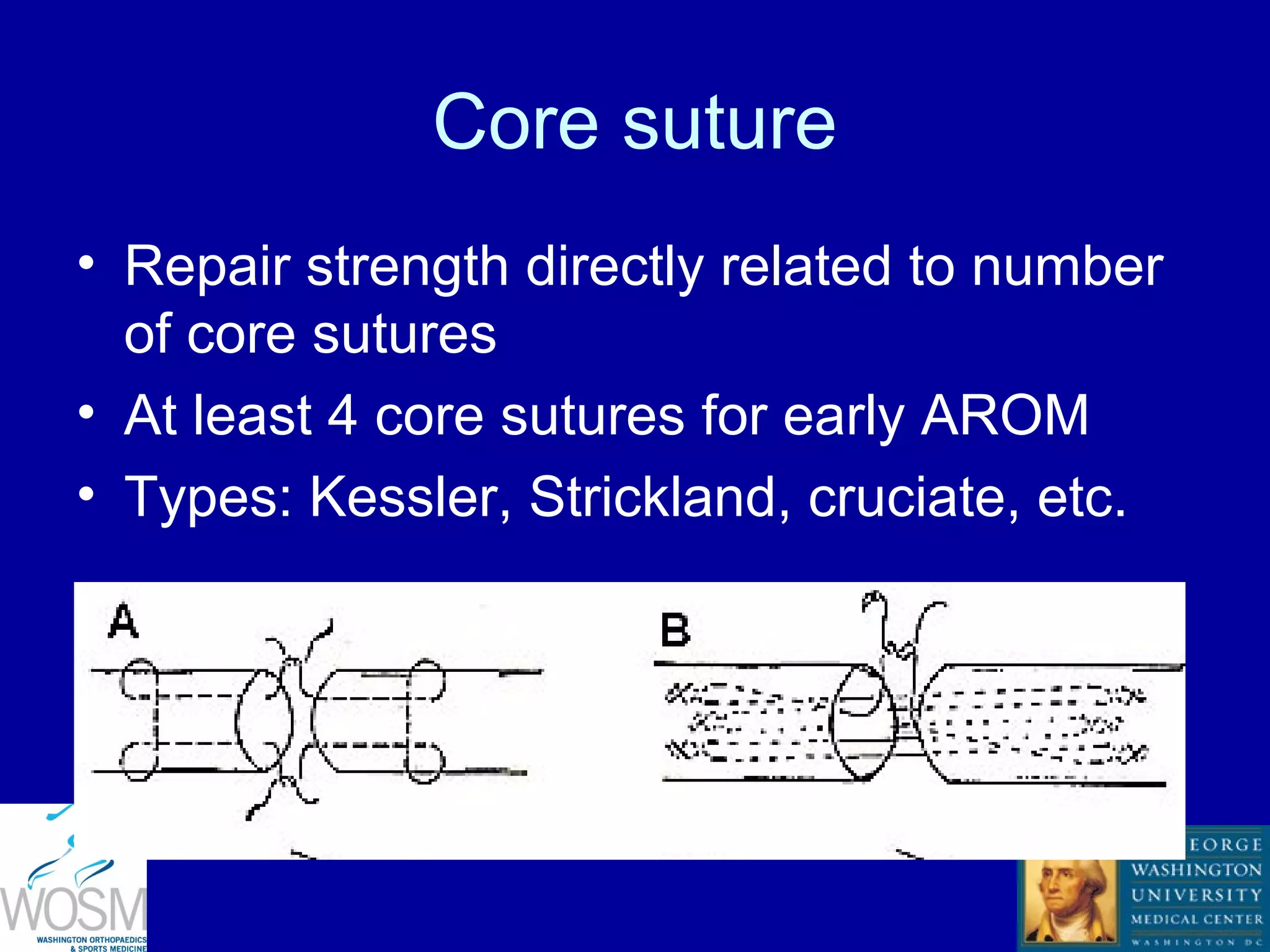 Flexor tendon injuries of the hand | PPT