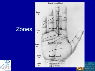 Flexor tendon injuries of the hand | PPT