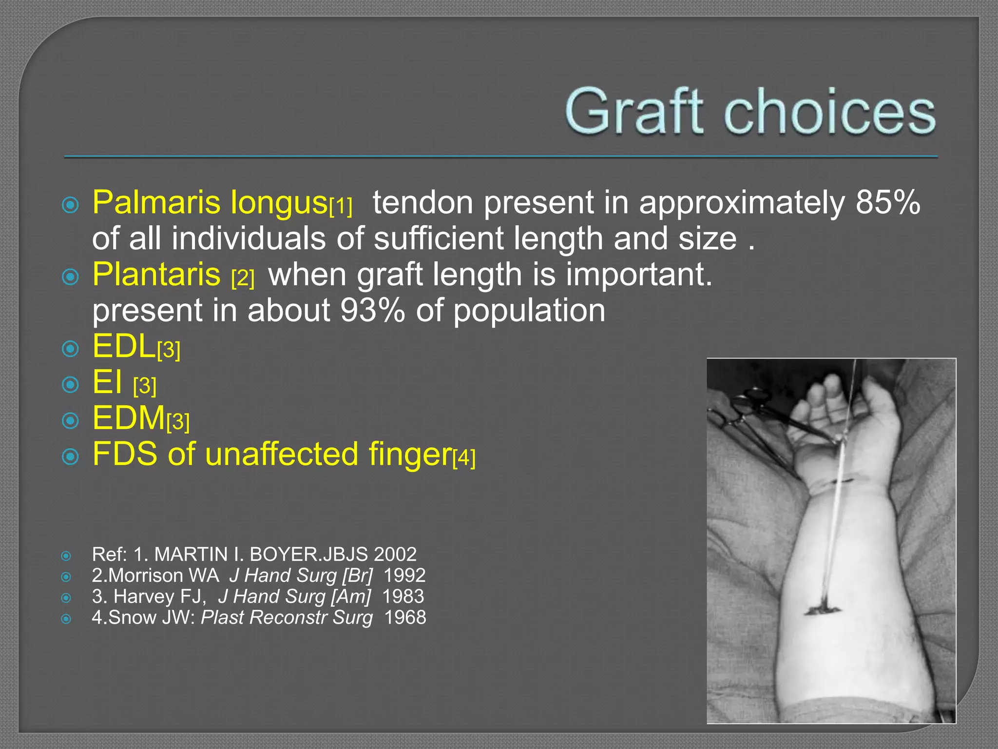 Flexor tendon injury | PPTX