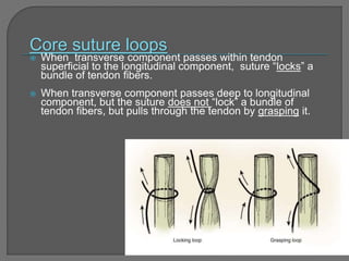Flexor tendon injury | PPTX