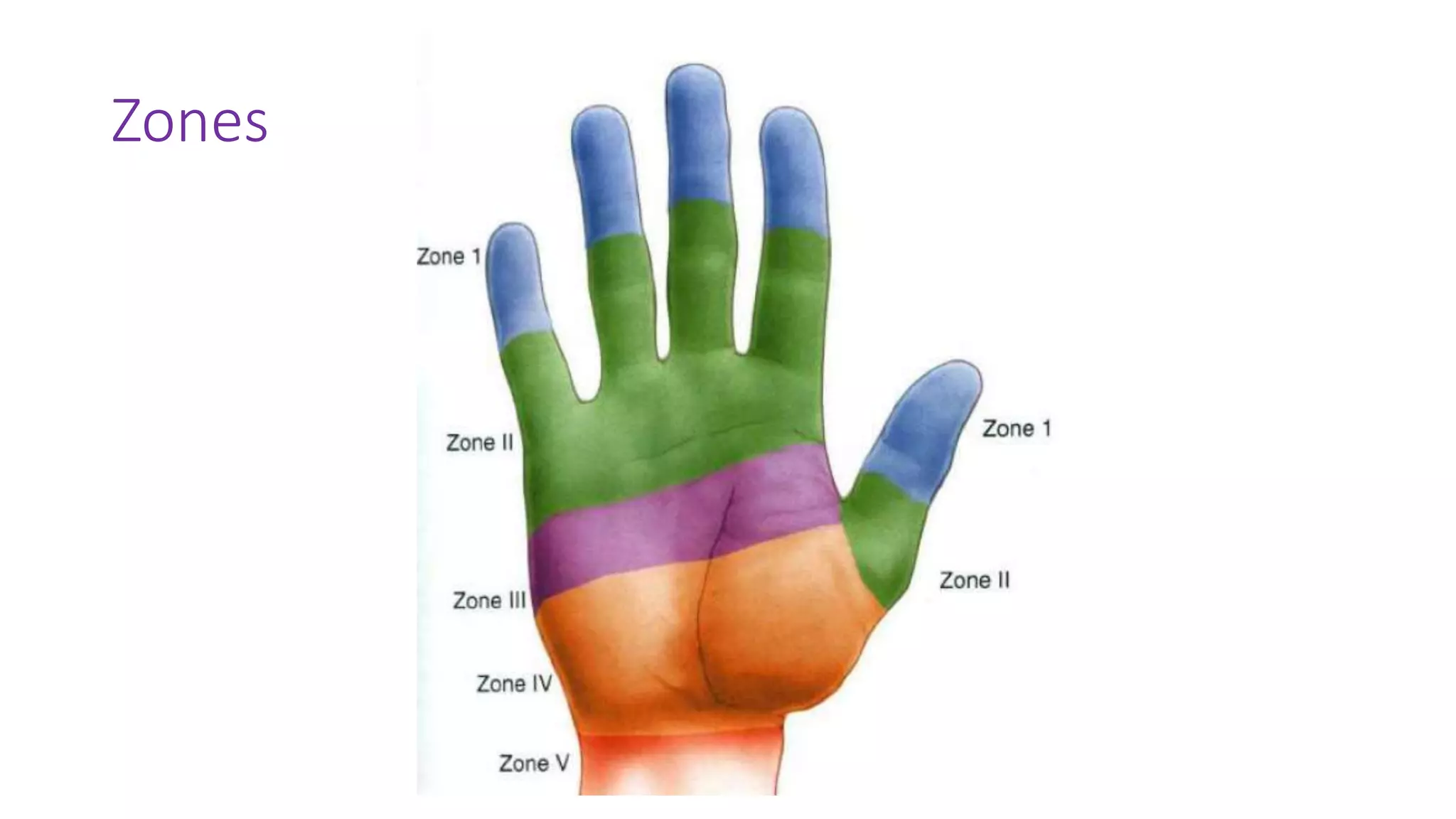 Flexor tendon injury | PPT