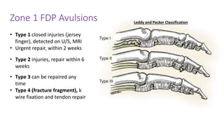 Flexor tendon injury | PPT