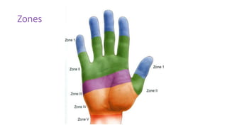 Flexor tendon injury | PPTX