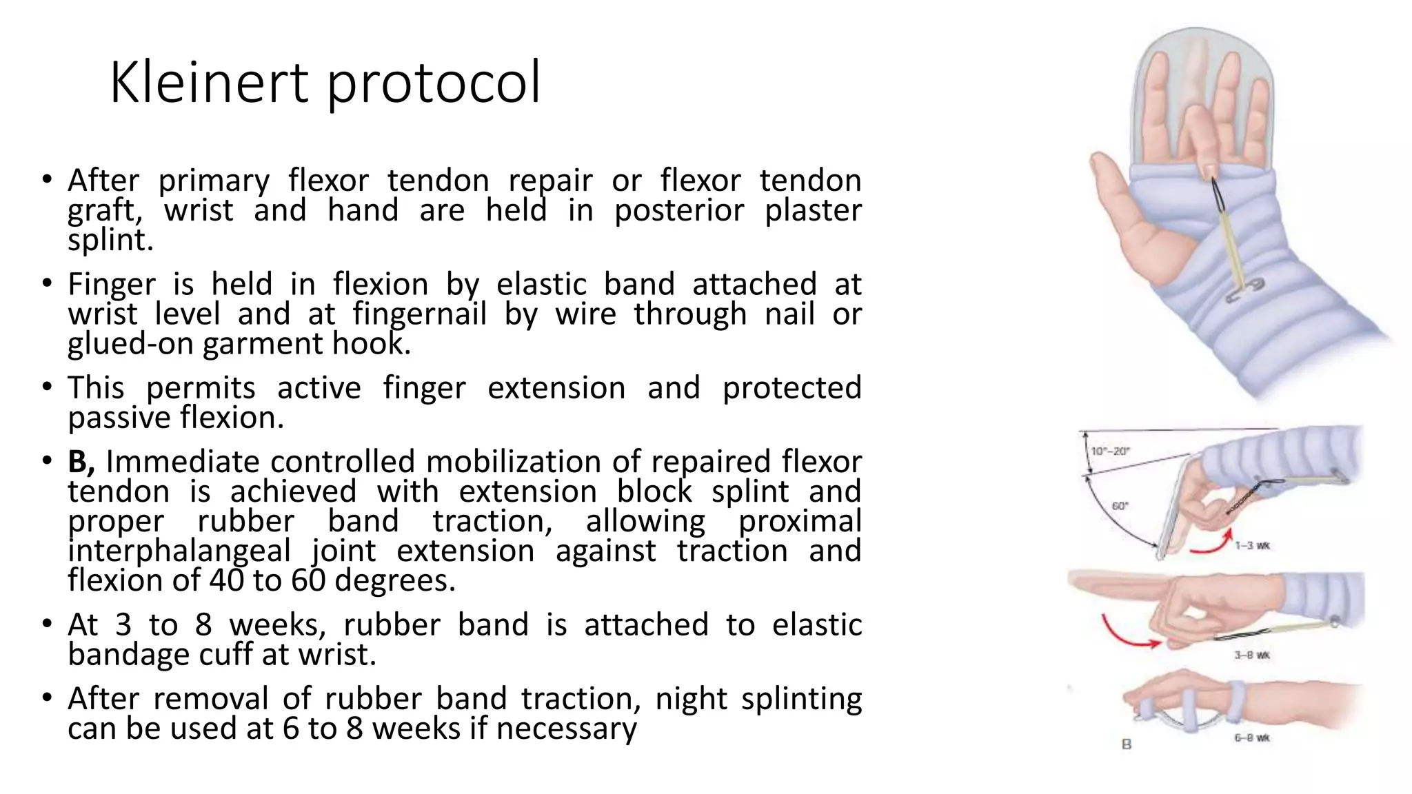 Flexor Tendon Injury.pptx