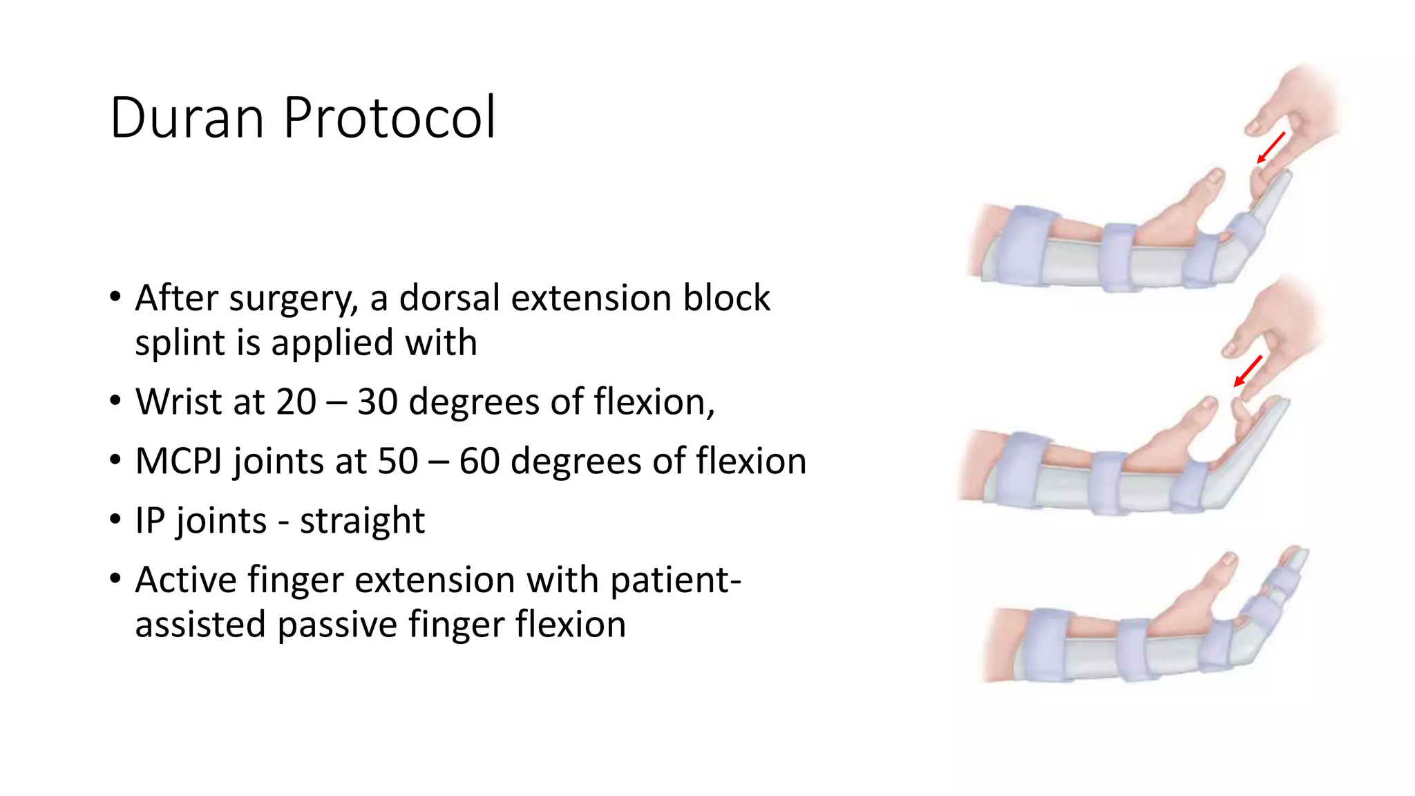 Flexor Tendon Injury.pptx