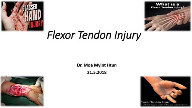 Flexor Tendon Injury.pptx