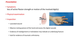 Flexor Tendon Injury.pptx