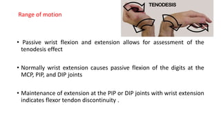 Flexor Tendon Injury.pptx