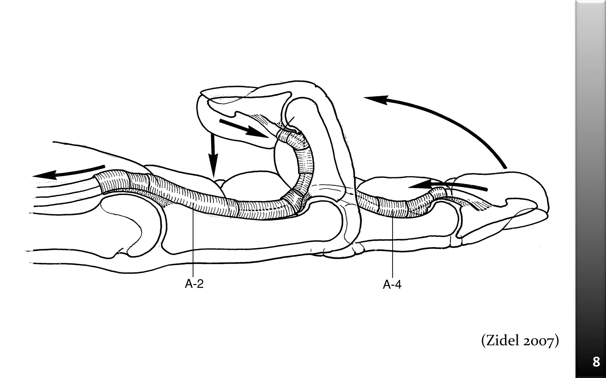 Flexor Tendon Injury | PDF
