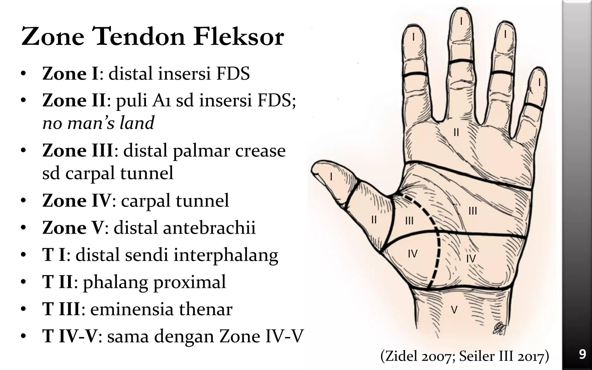 Flexor Tendon Injury | PDF