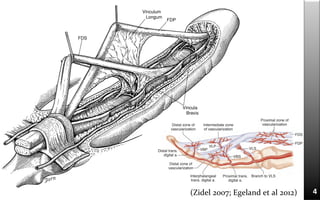 Flexor Tendon Injury | PPT