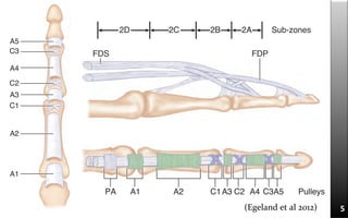 Flexor Tendon Injury | PPT