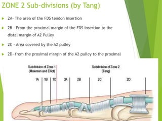 Flexor tendon injury final edit with pictures | PPTX