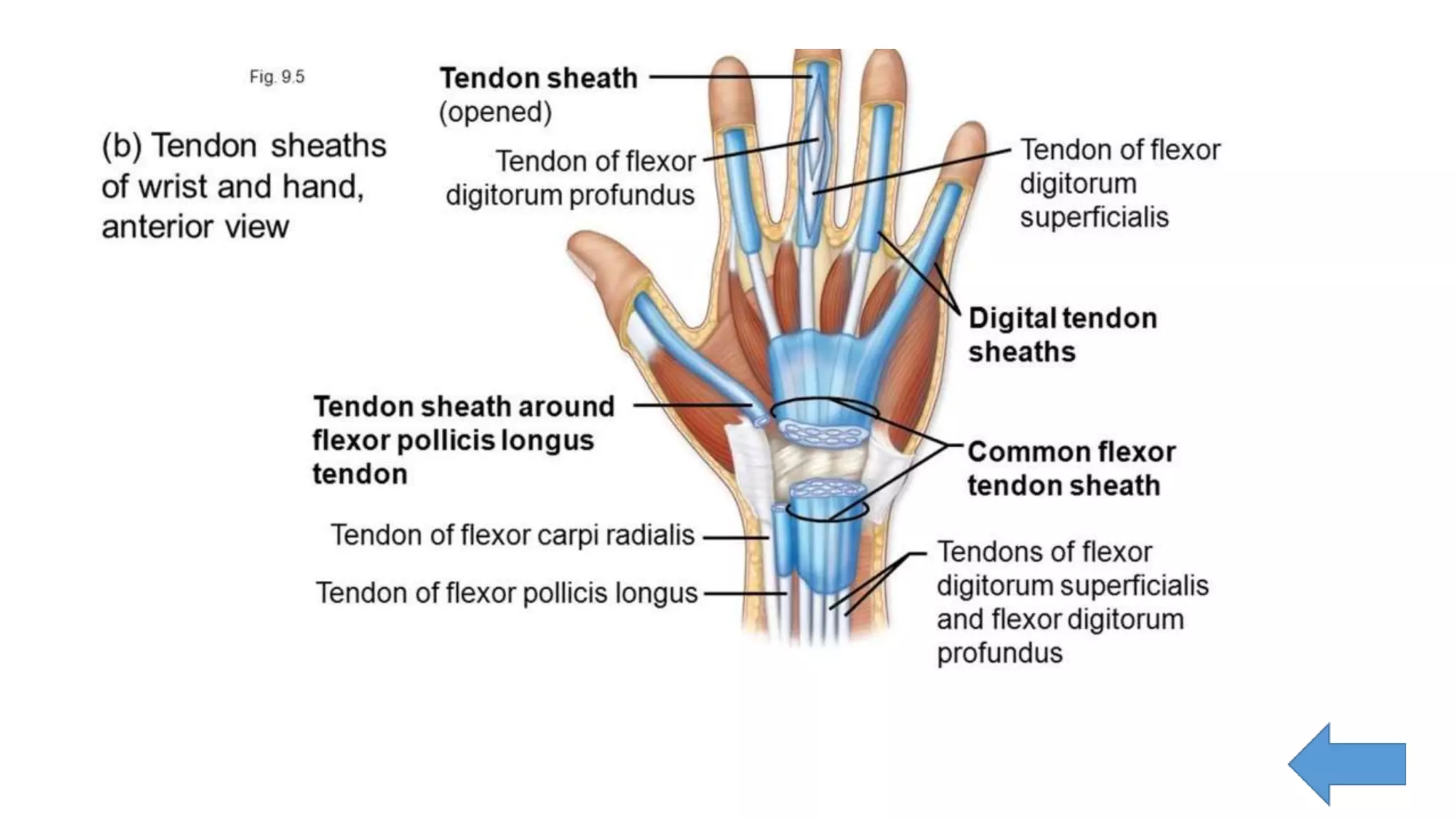 Flexor tendon injury, management and rehabilitation | PPTX